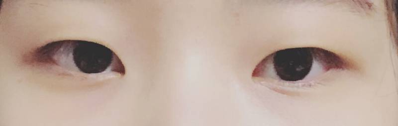 나 정면 카메라랑 후면카메라 눈이 너무 차이나는데 인스티즈 instiz 일상 카테고리