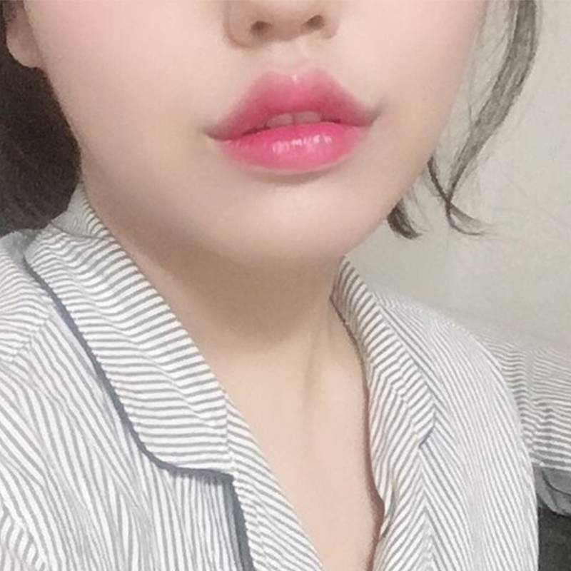 입술필러 맞았는데 이야 진짜; - 인스티즈(instiz) 뷰티 카테고리