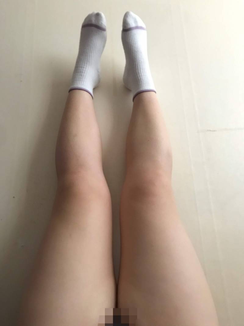 15kg 감량 전후 사진 40 - 인스티즈(instiz) 뷰티 카테고리