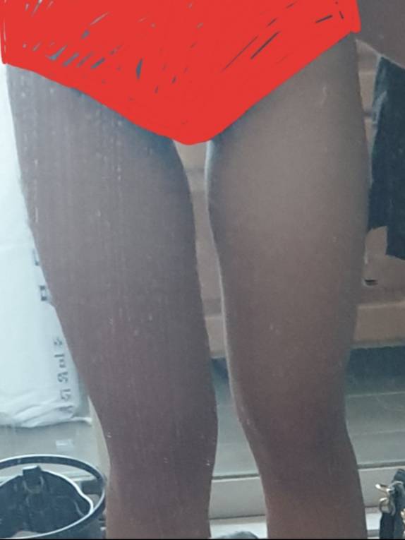 다이어트전후 허벅지비교4040 - 인스티즈(instiz) 일상 카테고리