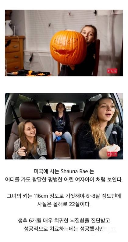 하이랜더 증후군 실제사례들 인스티즈instiz 인티포털 카테고리