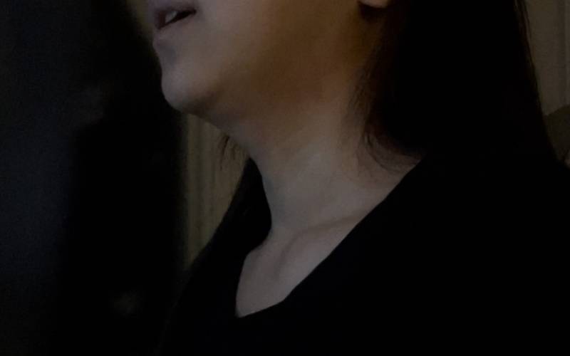 170cm / 50kg 인데 이럼.. 성형이 답인가? - 인스티즈(instiz) 익명잡담 카테고리