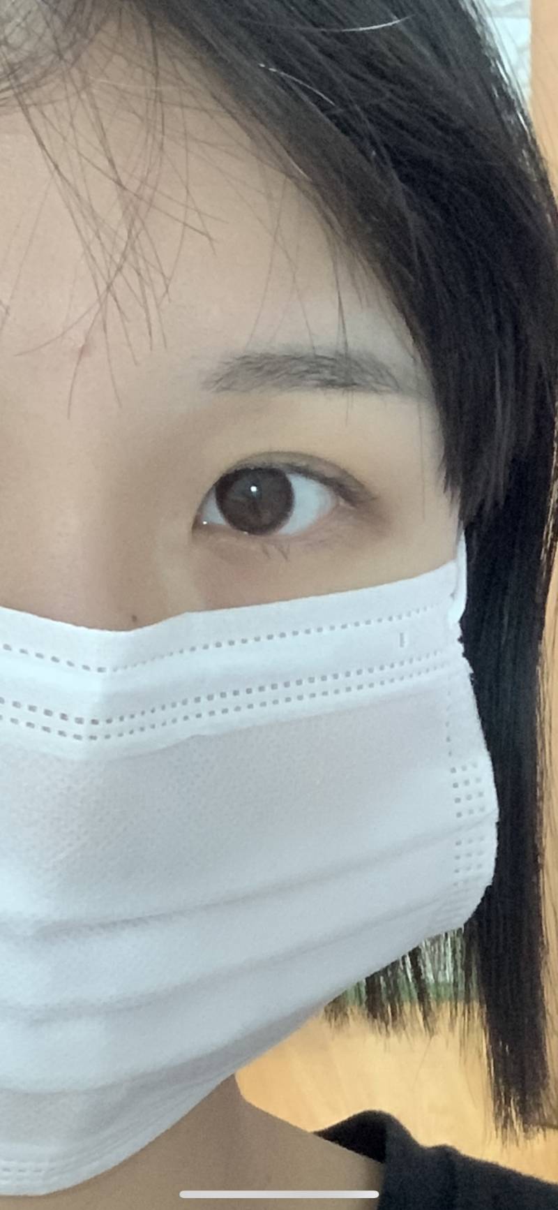 이정도면 쌍수 as 해줄까? - 인스티즈(instiz) 일상 카테고리