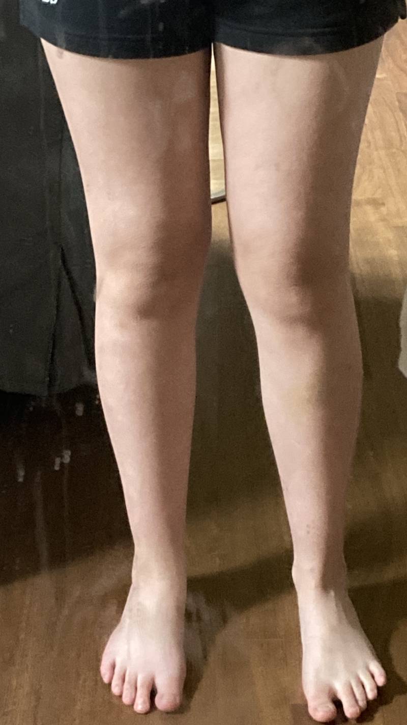 키 163인데 몇키로같아보여? - 인스티즈(instiz) 일상 카테고리