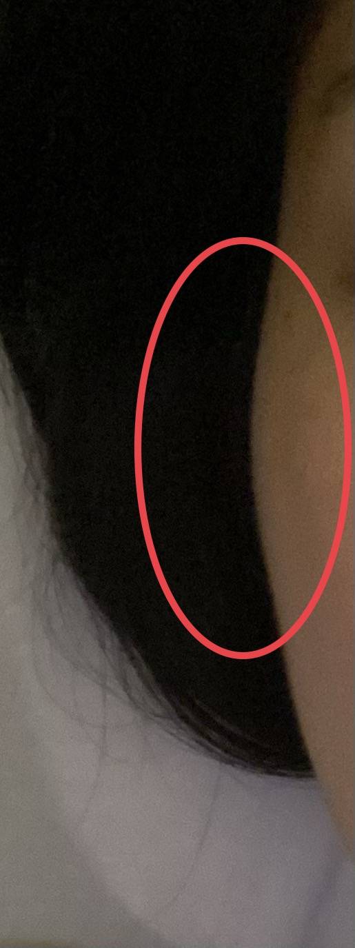 이게 옆광대인 거지?? 괄사로 조지면 안 되나?(40) - 인스티즈(instiz) 일상 카테고리