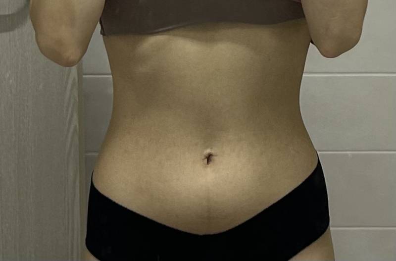 [잡담] 체지방 18% .. 8kg대인데 .. 아랫배 왜이럴까 .. - 인스티즈(instiz) 일상 카테고리