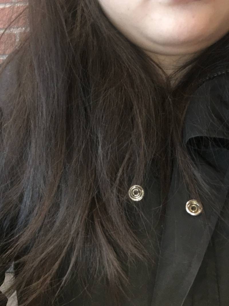 지흡하면 투턱도제거해줌? - 인스티즈(instiz) 일상 카테고리