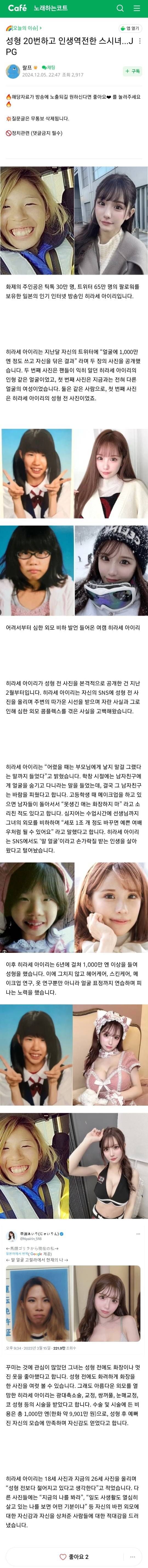 성형 20번하고 인생역전한 일본여자...JPG - 인스티즈(instiz) 이슈 카테고리