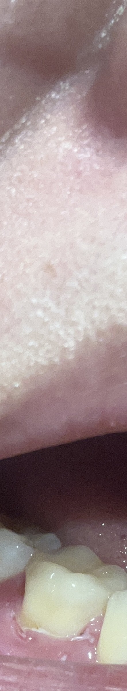 (혐주의) 이거 구내염이야…? - 인스티즈(instiz) 연예 카테고리