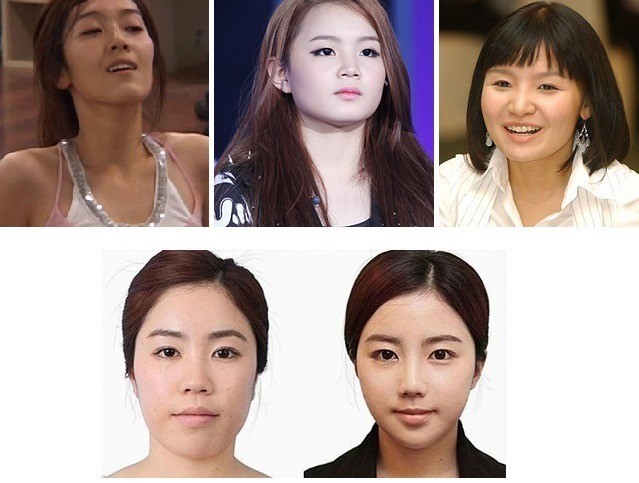 남자 외모에 중요한 T존, 여자 외모에 중요한 U존 - 인스티즈(instiz) 이슈 카테고리