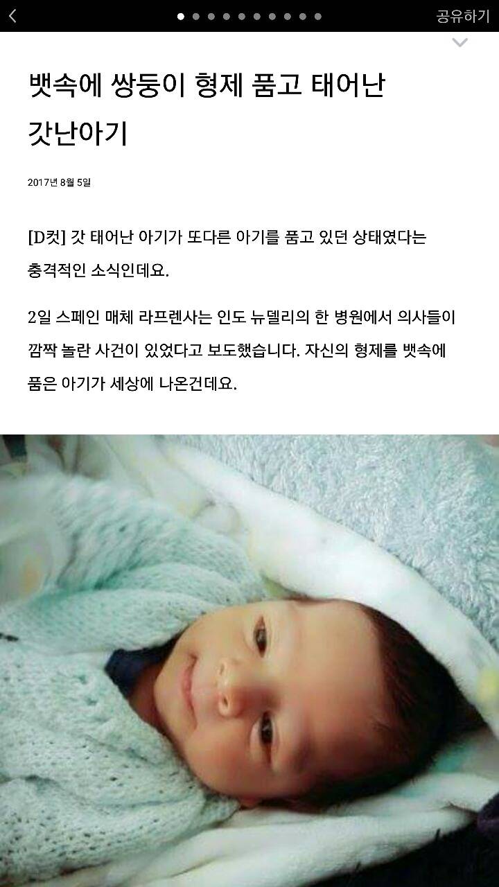뱃속에 쌍둥이 형제 품고 태어난 갓난아기 인스티즈 Instiz 이슈 카테고리