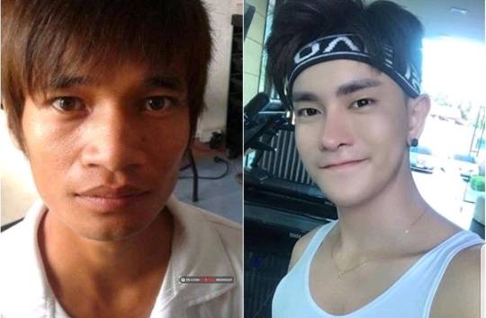 30번 성형한 태국 남성 - 인스티즈(instiz) 이슈 카테고리