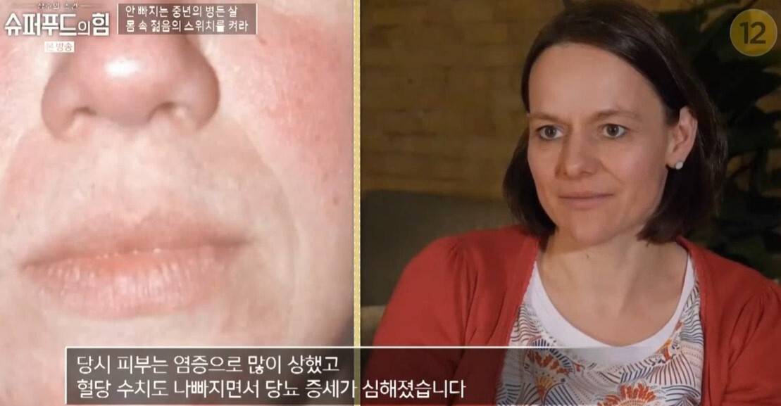 음식만 바꿔도 15kg가 빠질 수 있다는 증거 - 인스티즈(instiz) 인티포털 카테고리