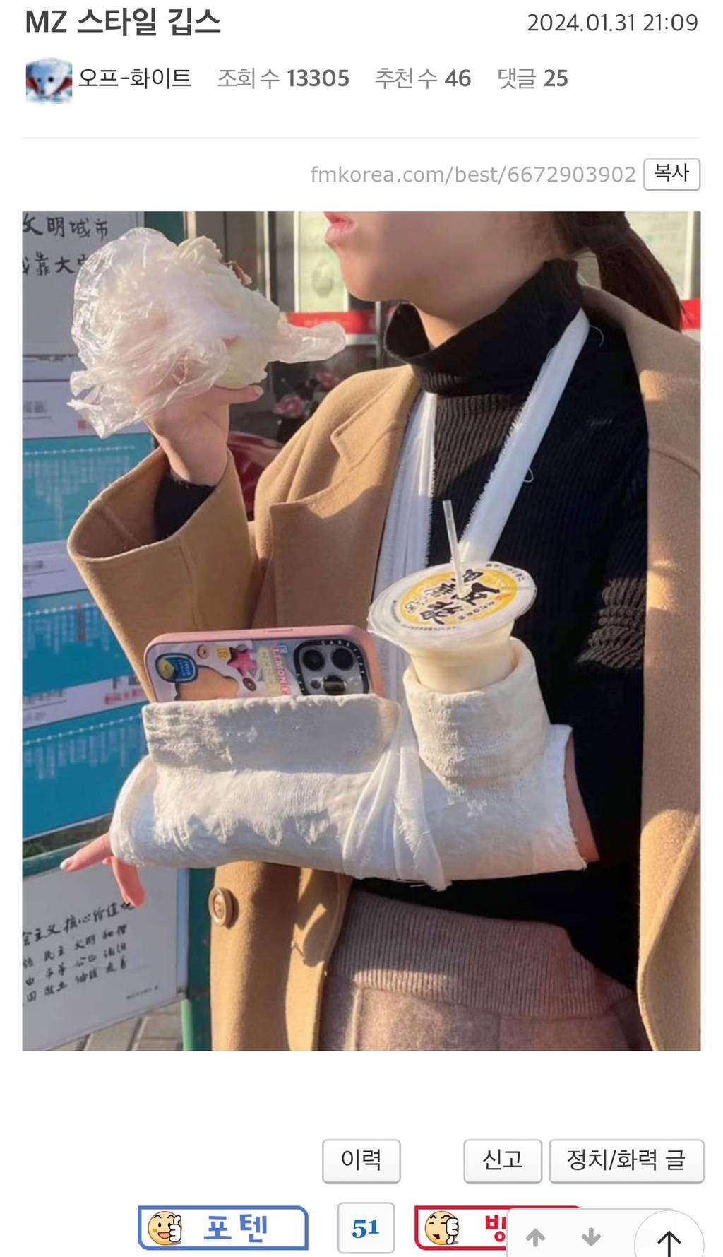 MZ 스타일 깁스 - 인스티즈(instiz) 이슈 카테고리