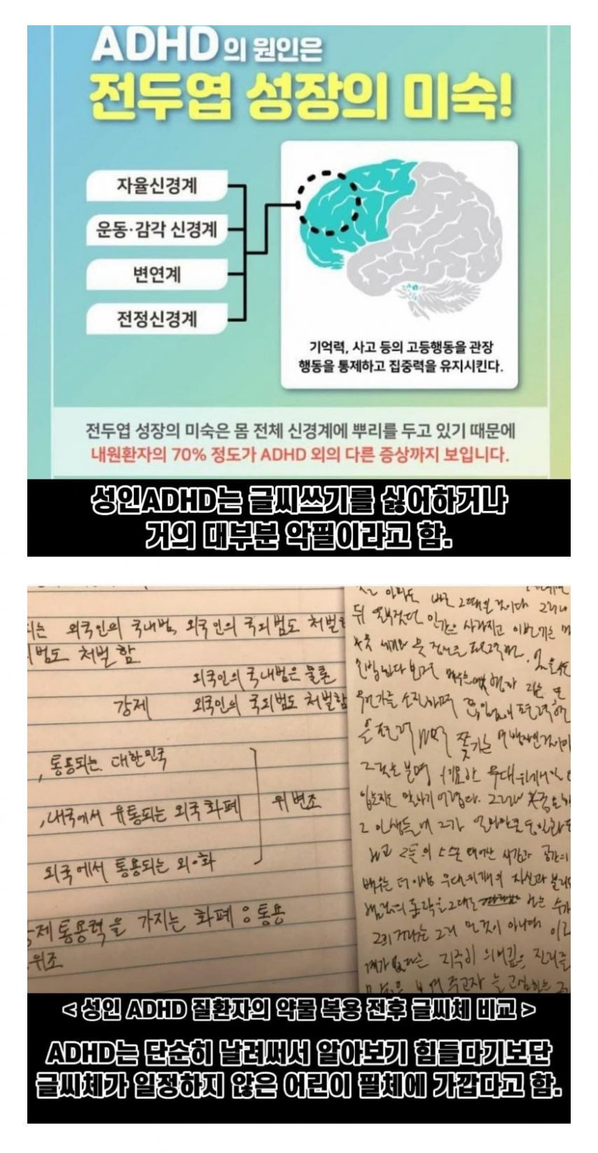 성인 ADHD 환자들의 필체 - 인스티즈(instiz) 이슈 카테고리