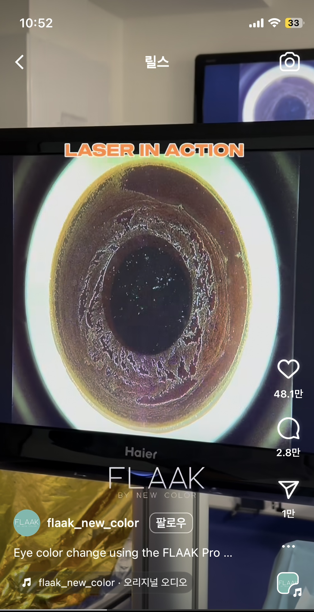 눈동자 타투 - 인스티즈(instiz) 이슈 카테고리